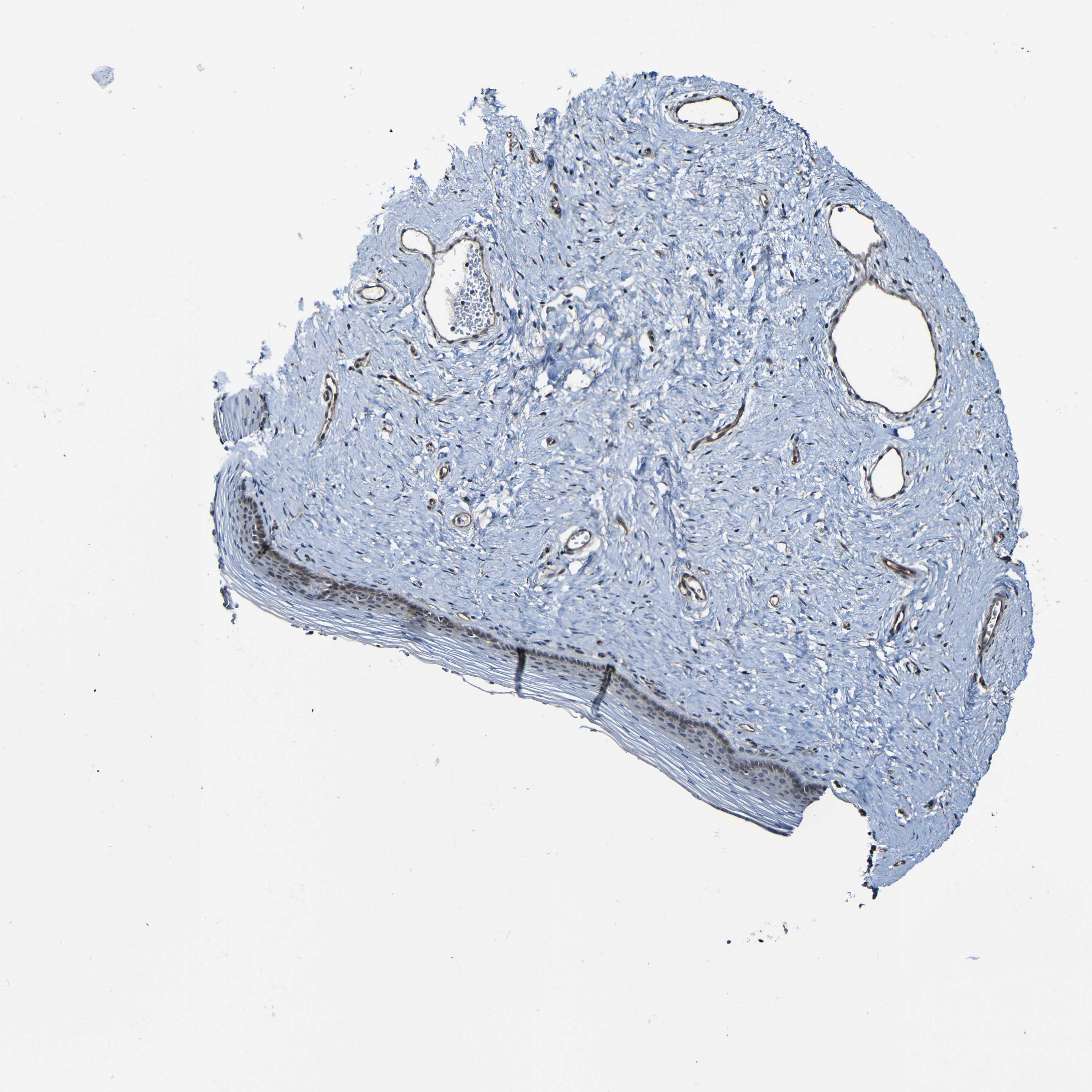 Tissue Expression Of Lgr5 Staining In Vagina The Human Protein Atlas