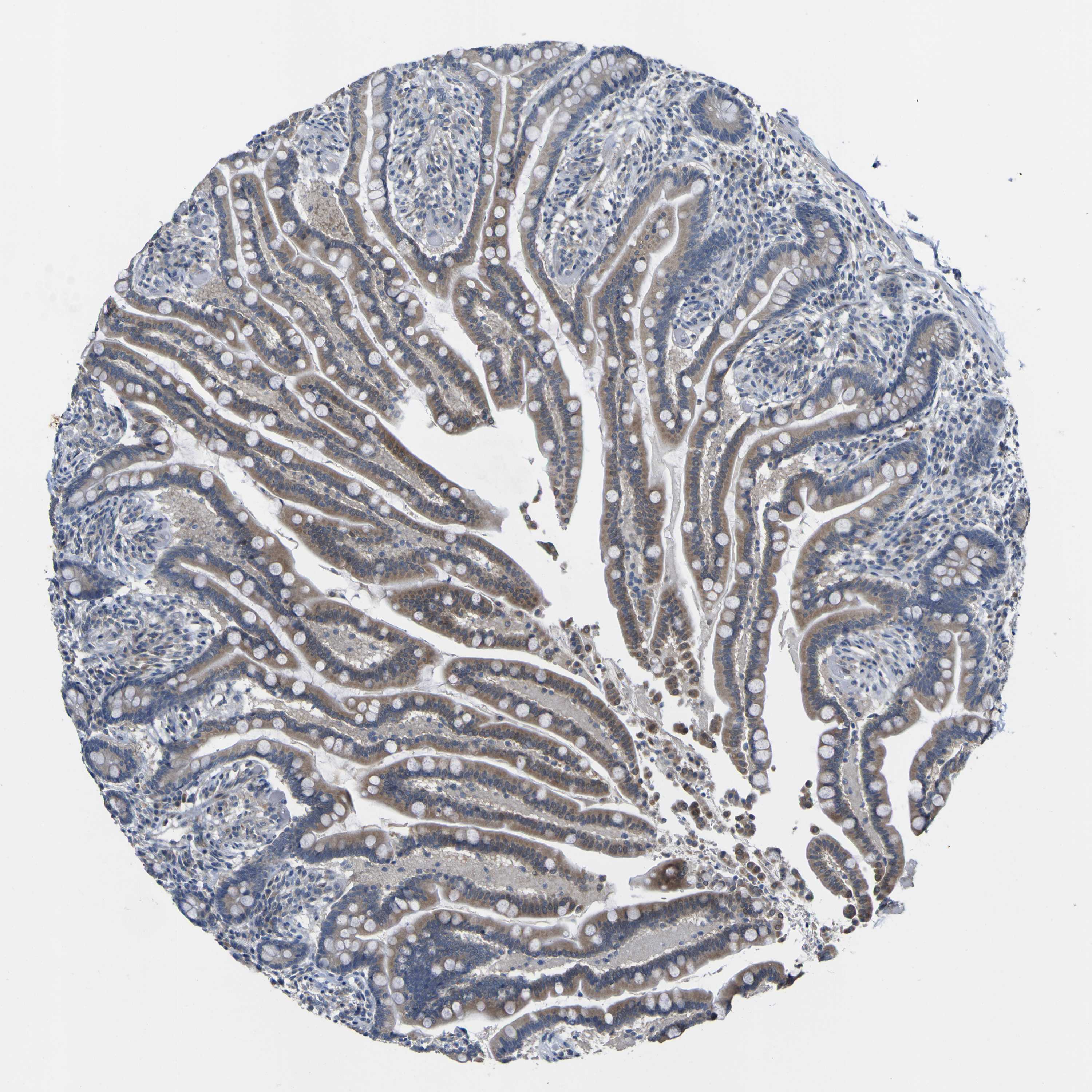 Tissue Expression Of Ldlr Staining In Colon The Human Protein Atlas