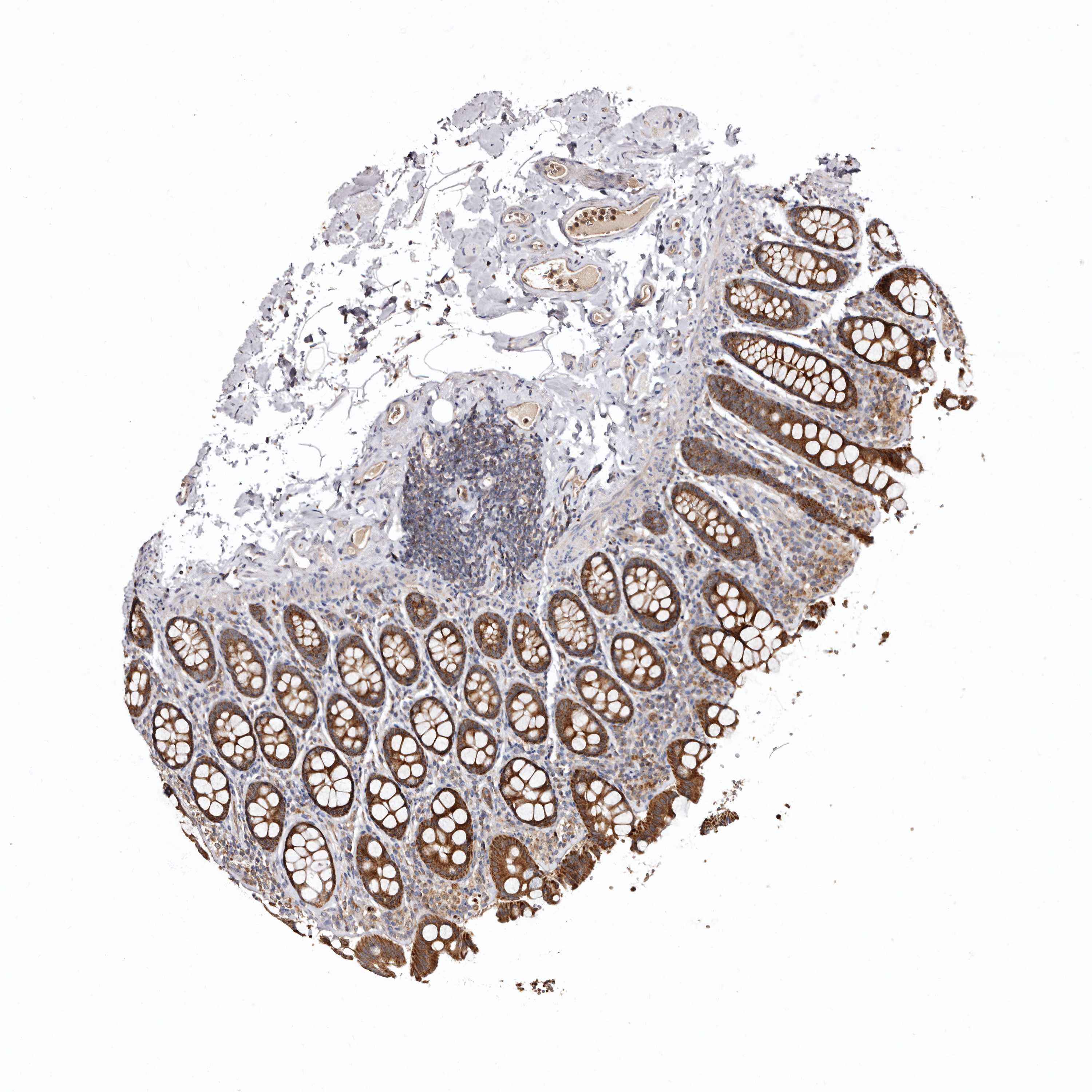 Tissue Expression Of Bax Staining In Colon The Human Protein Atlas