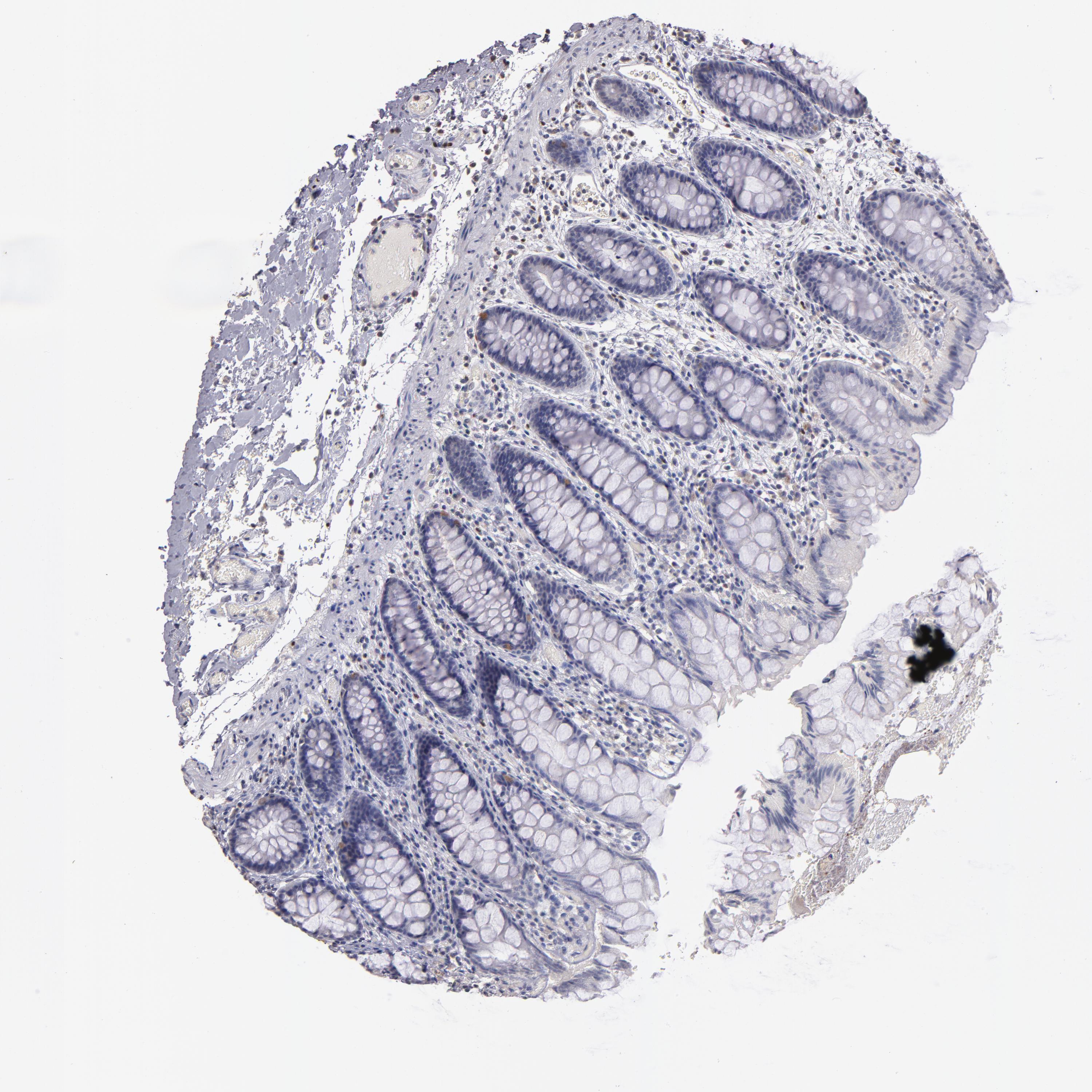 Tissue Expression Of Sox10 Staining In Colon The Human Protein Atlas