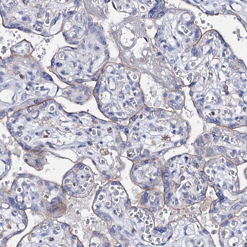PLIN1 - Antibodies - The Human Protein Atlas