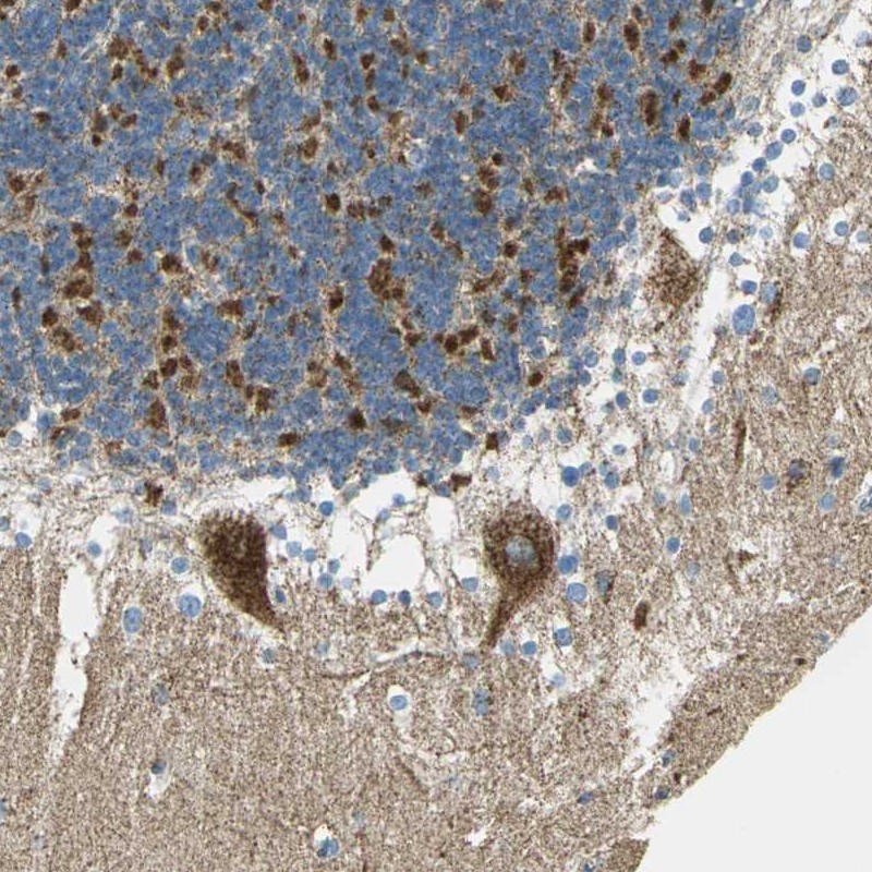 NTRK1 - Antibodies - The Human Protein Atlas