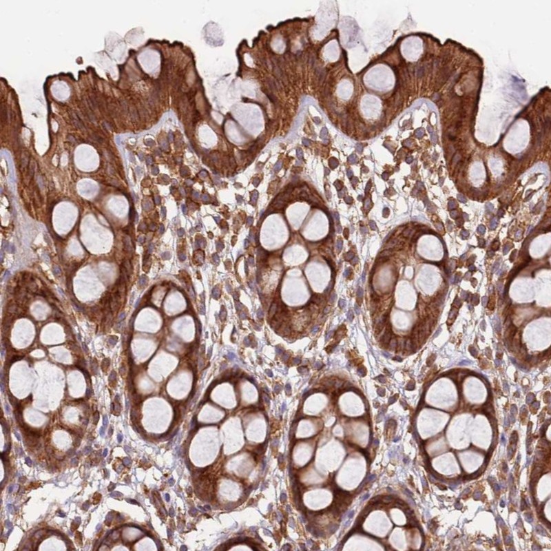 ACVR2A - Antibodies - The Human Protein Atlas