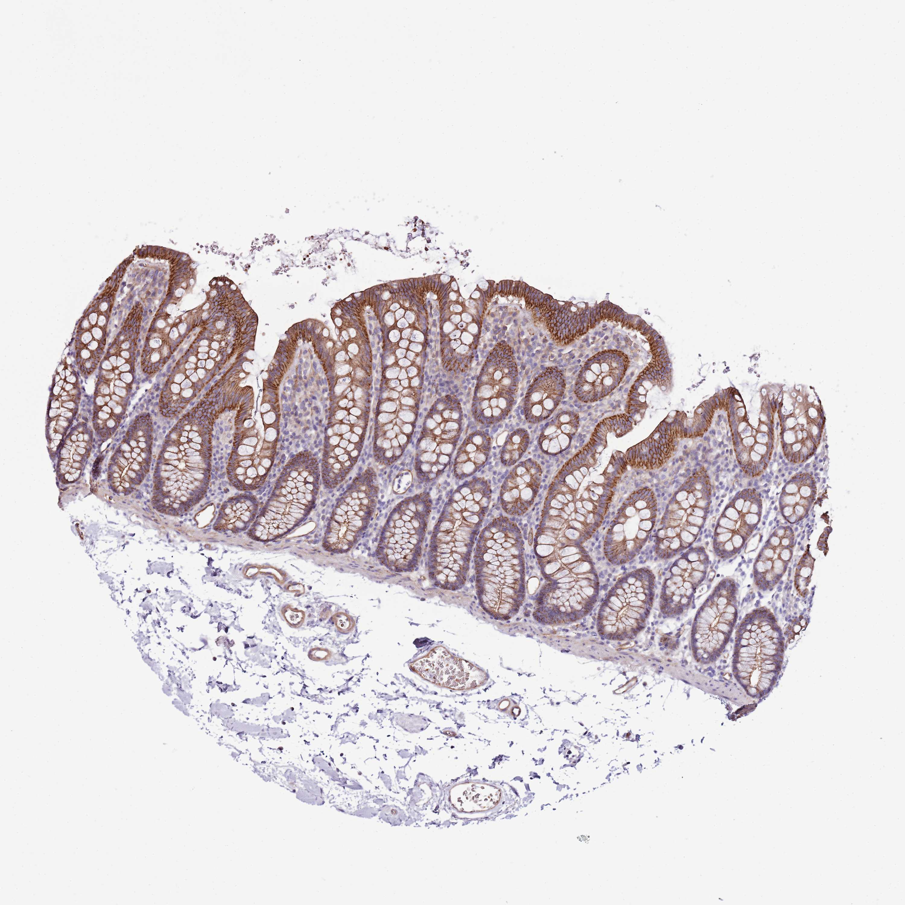 Tissue Expression Of Gfral Staining In Colon The Human Protein Atlas