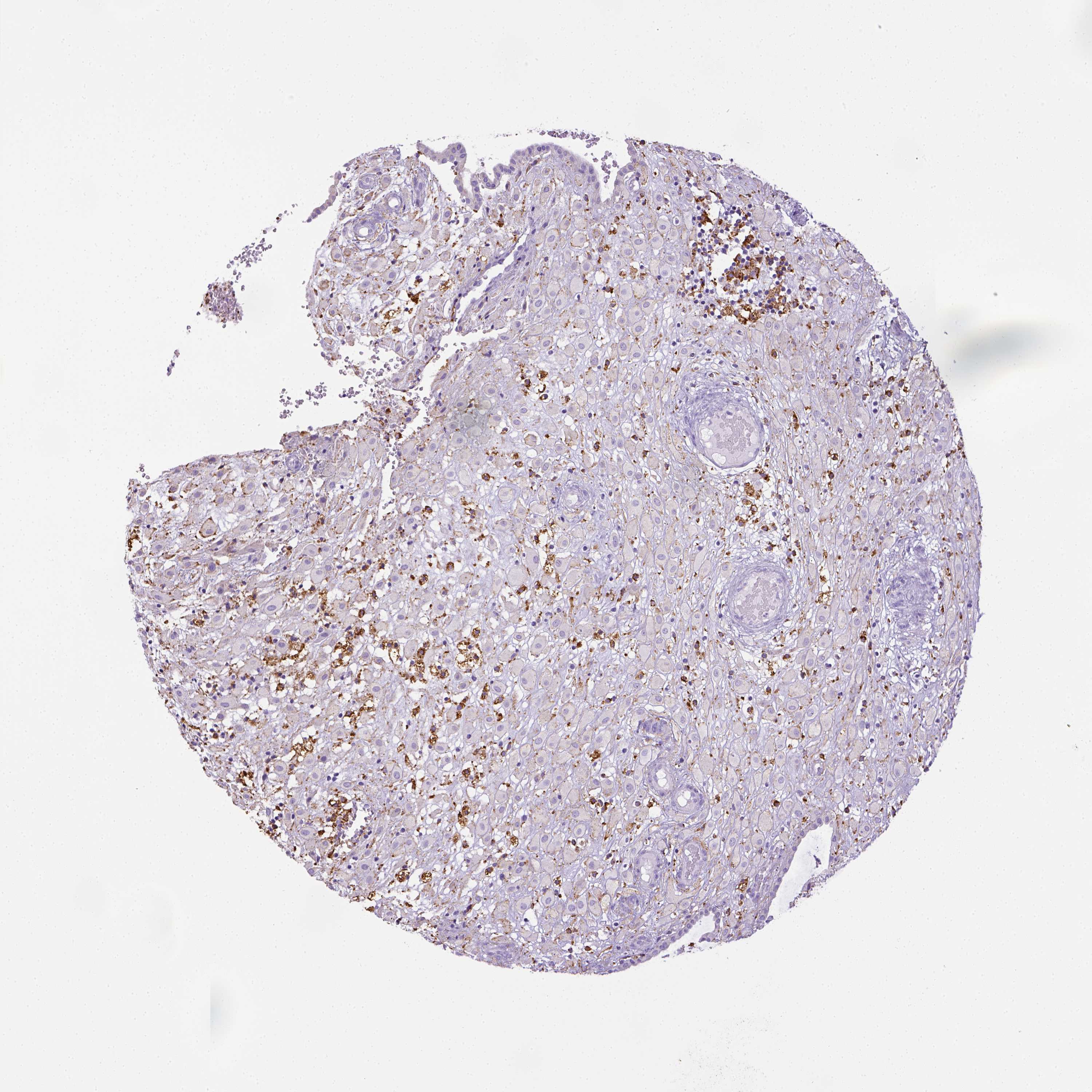 Tissue Expression Of Cd68 Staining In Placenta The Human Protein Atlas