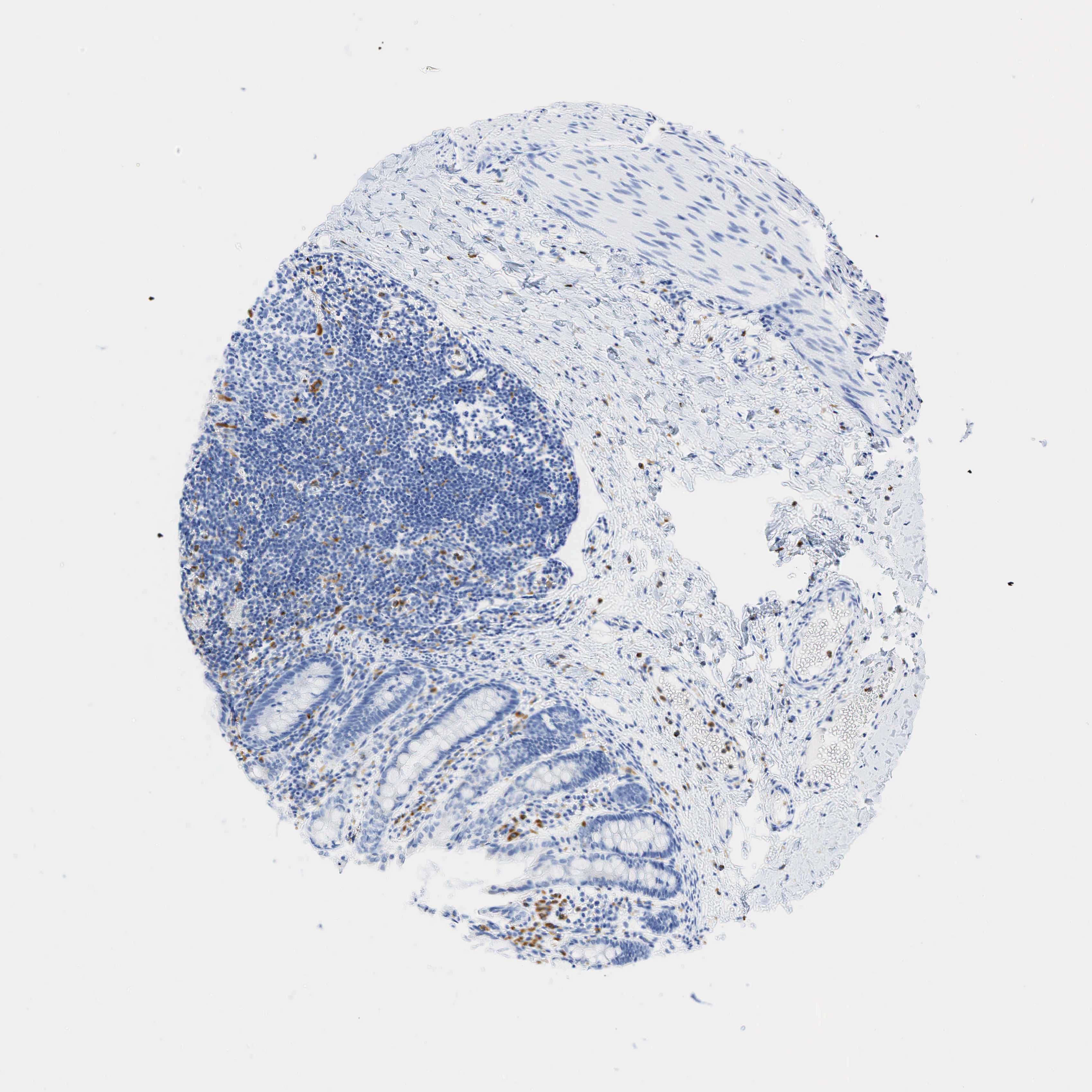 Tissue Expression Of Cd68 Staining In Colon The Human Protein Atlas