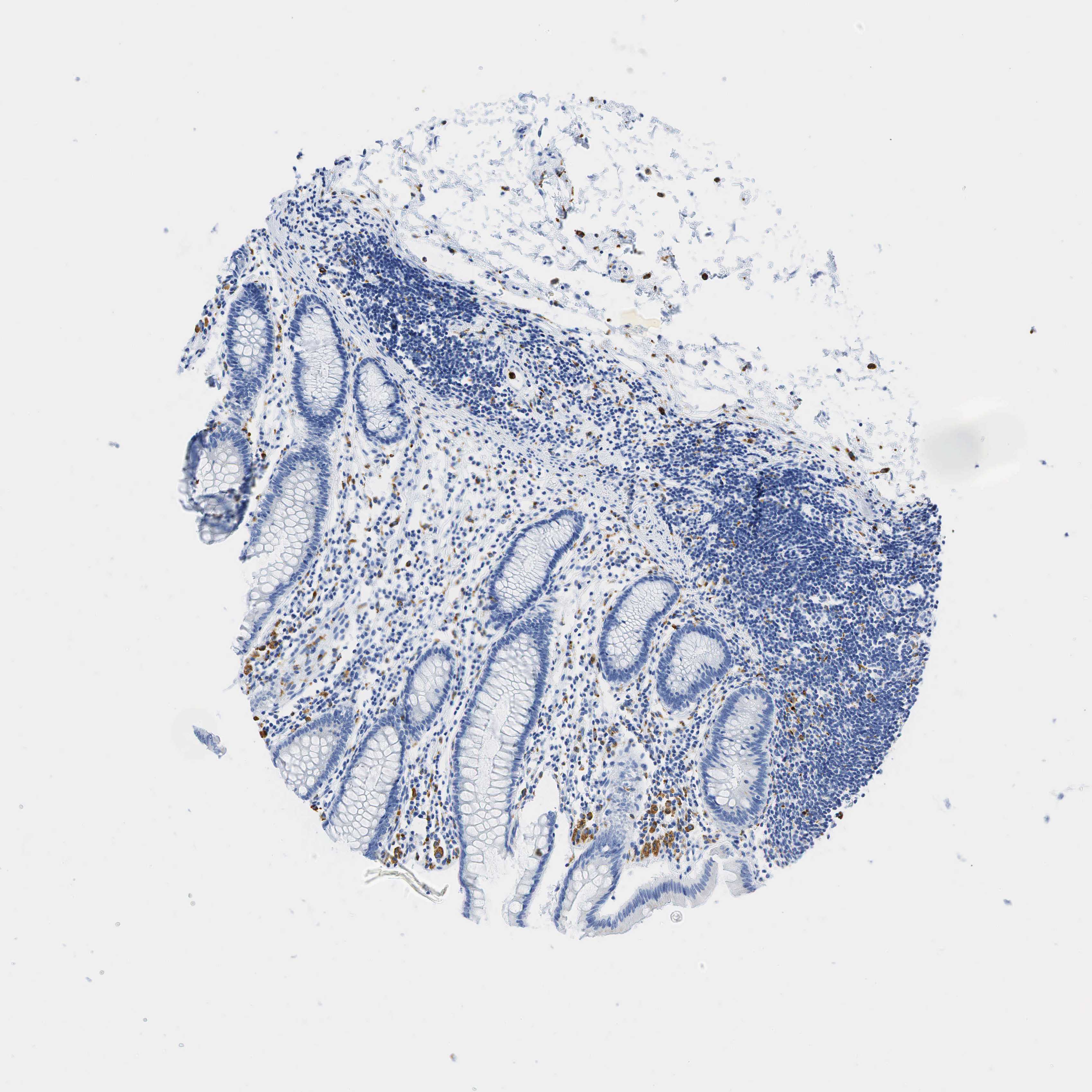 Tissue Expression Of Cd68 Staining In Colon The Human Protein Atlas