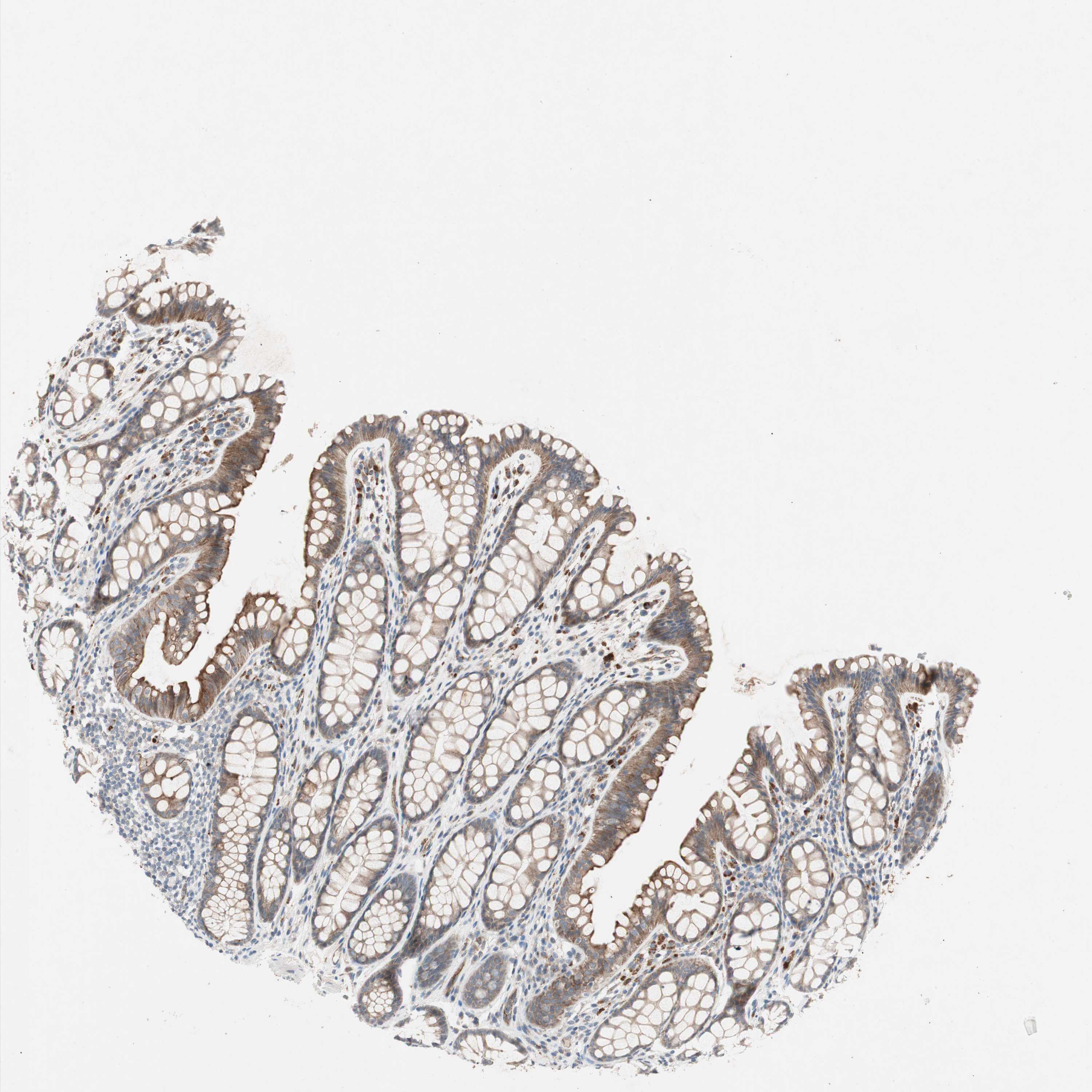 Tissue Expression Of Fgfr4 Staining In Colon The Human Protein Atlas