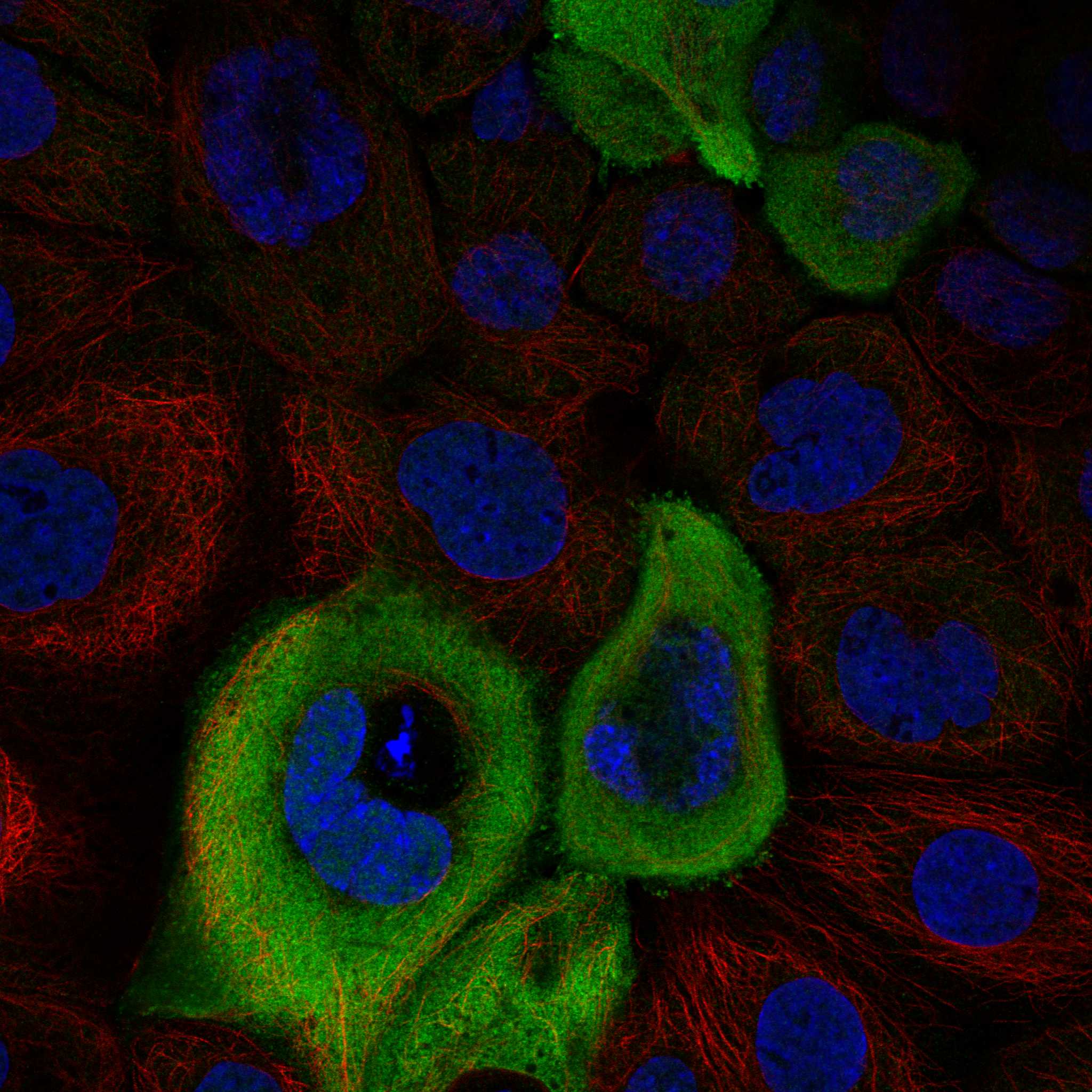 Subcellular - ENO1 - The Human Protein Atlas Subcellular - ENO1 - The Human Protein Atlas