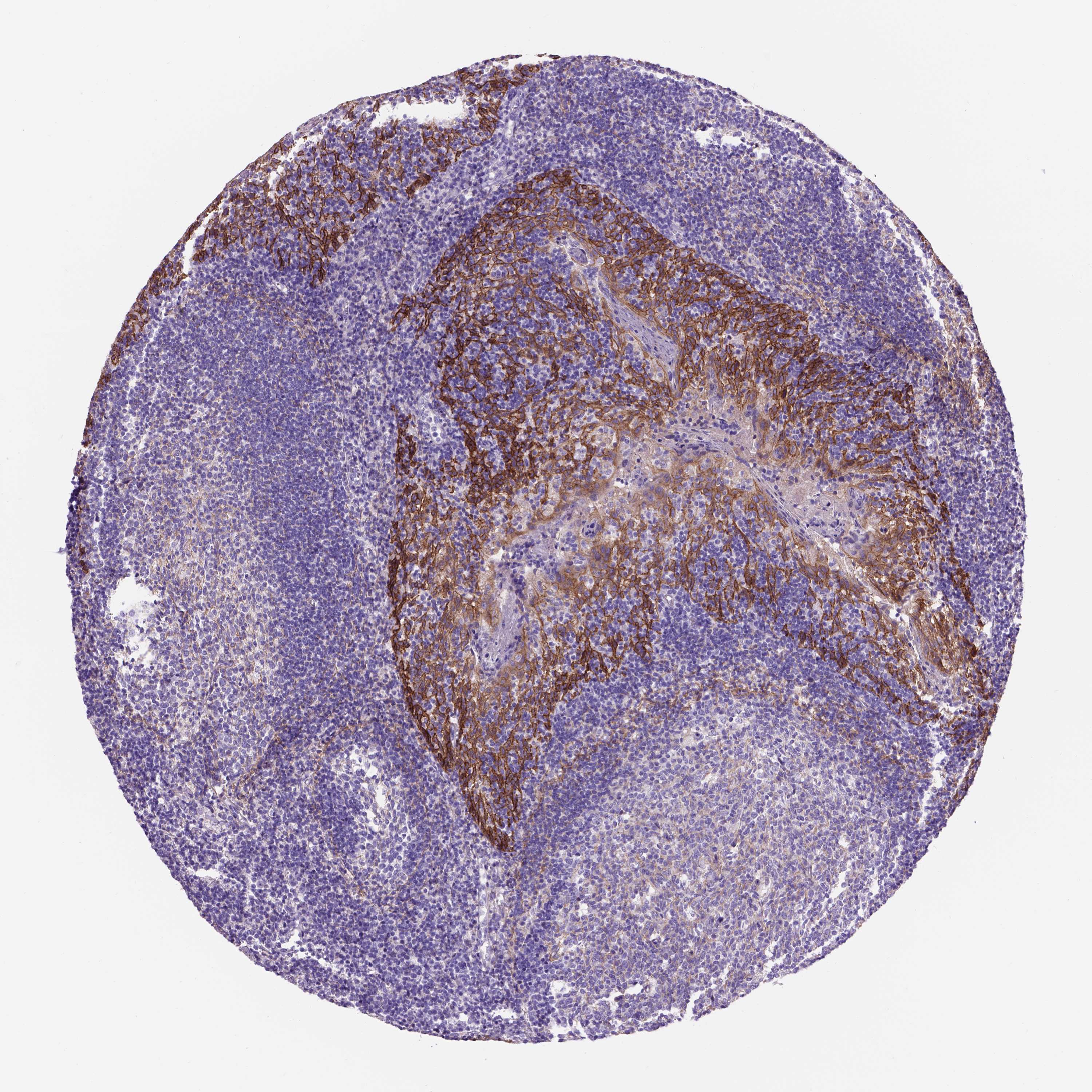Tissue expression of EGFR - Staining in tonsil - The Human Protein Atlas Tissue expression of EGFR - Staining in tonsil - The Human Protein Atlas