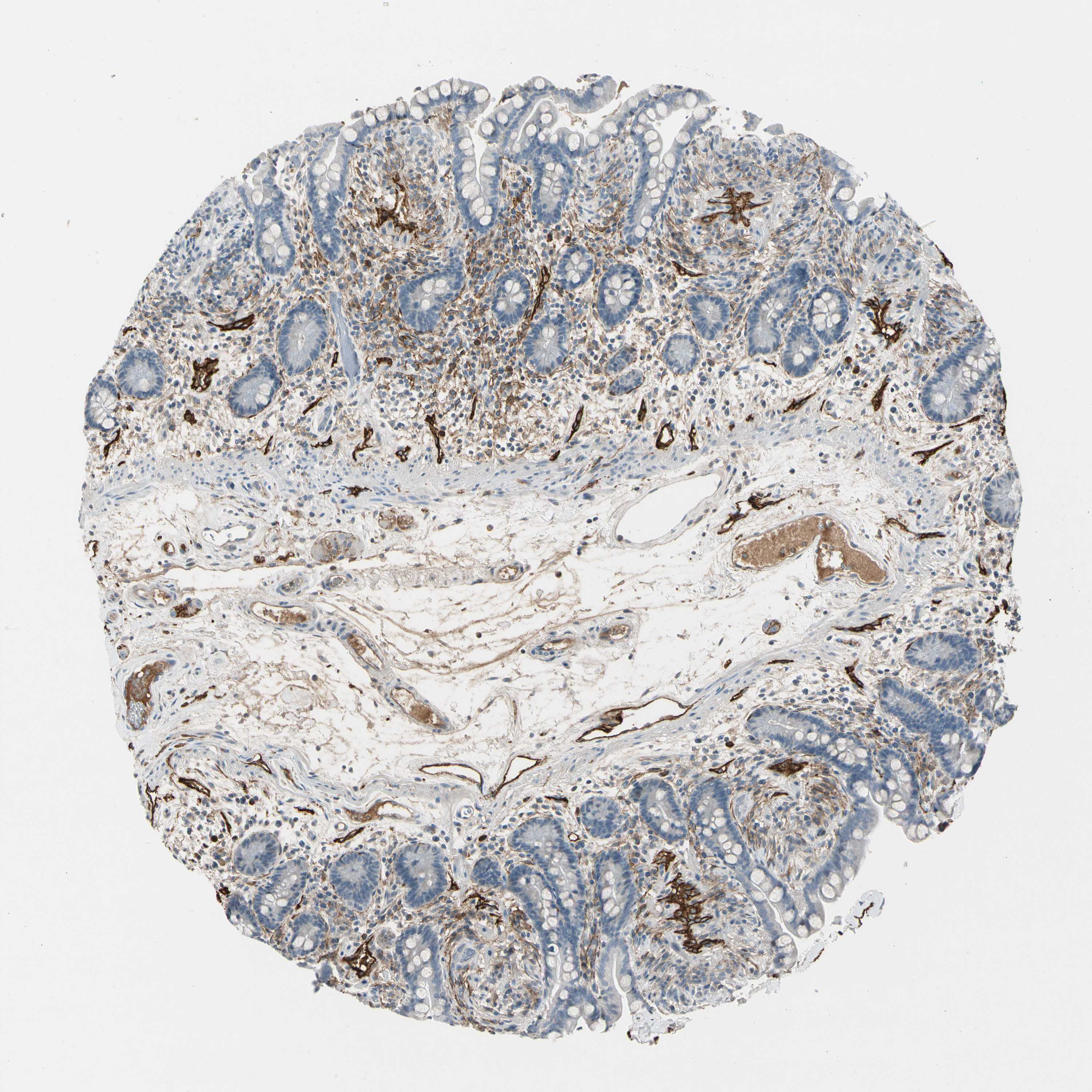 Tissue Expression Of Pdpn Staining In Colon The Human Protein Atlas
