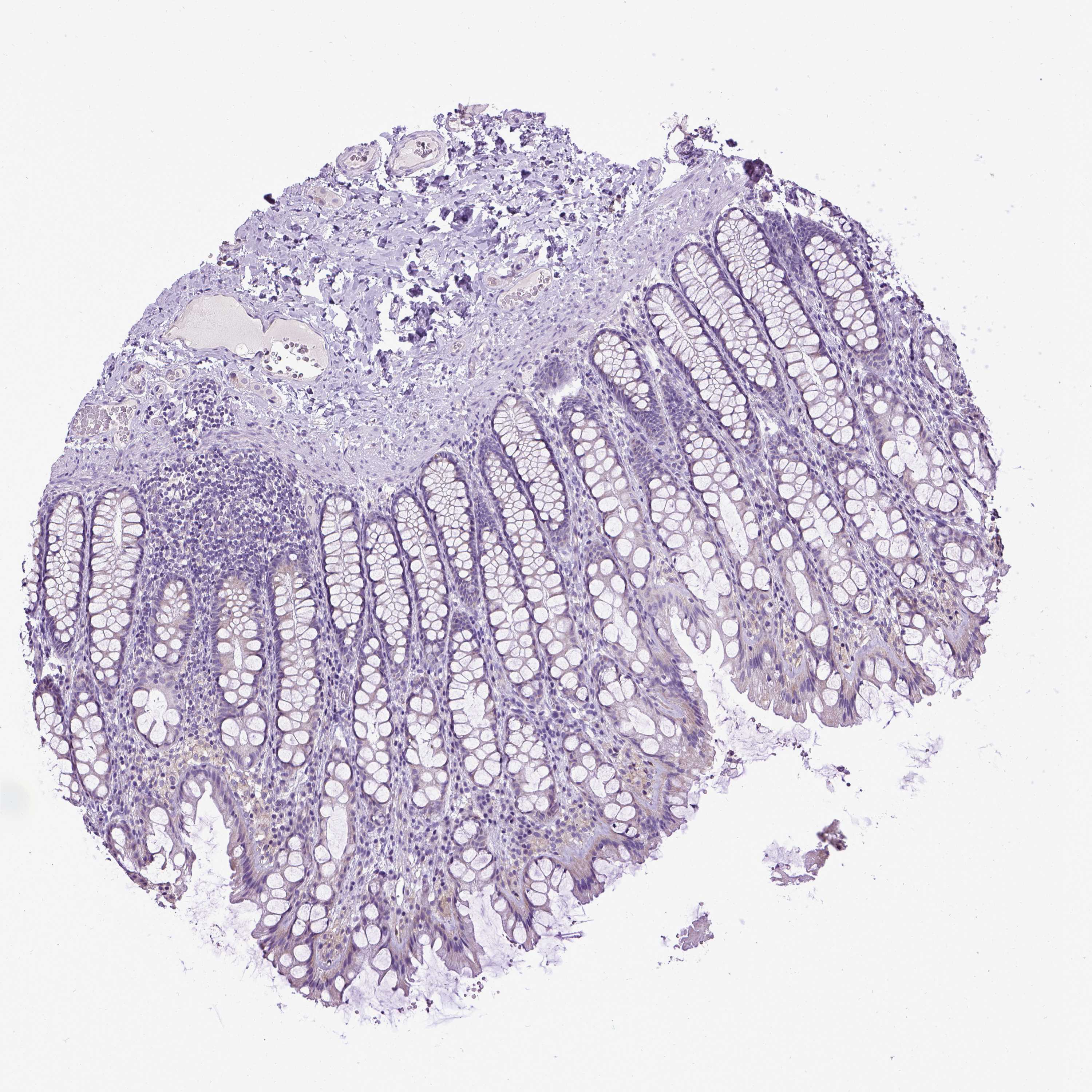 Tissue Expression Of Eng Staining In Colon The Human Protein Atlas
