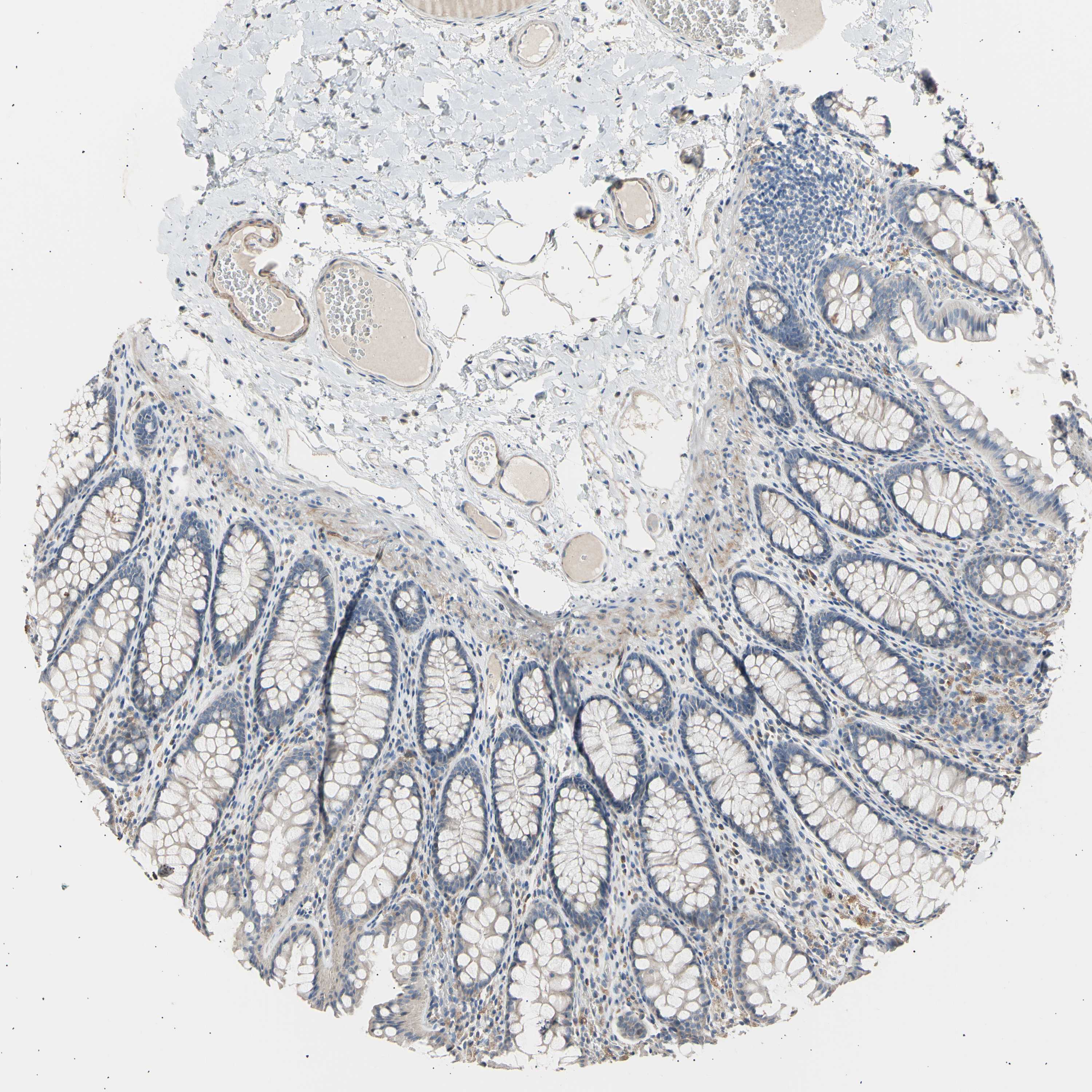 Tissue Expression Of Ldlr Staining In Colon The Human Protein Atlas
